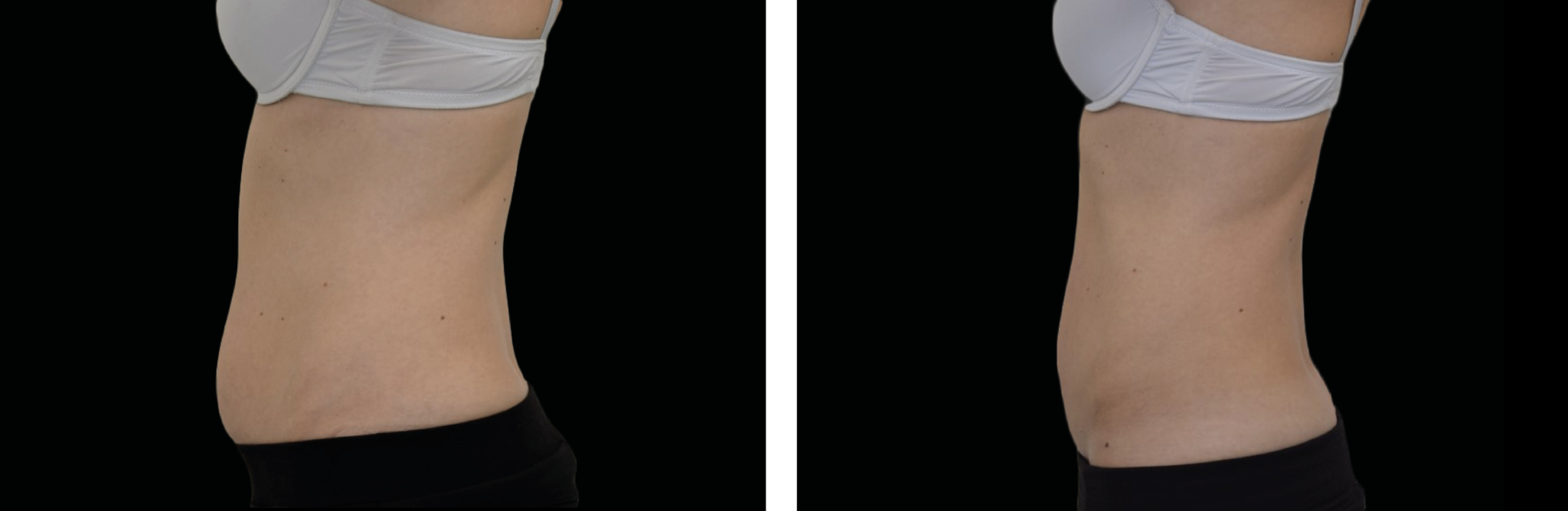 EXION™ BODY - Becoming You